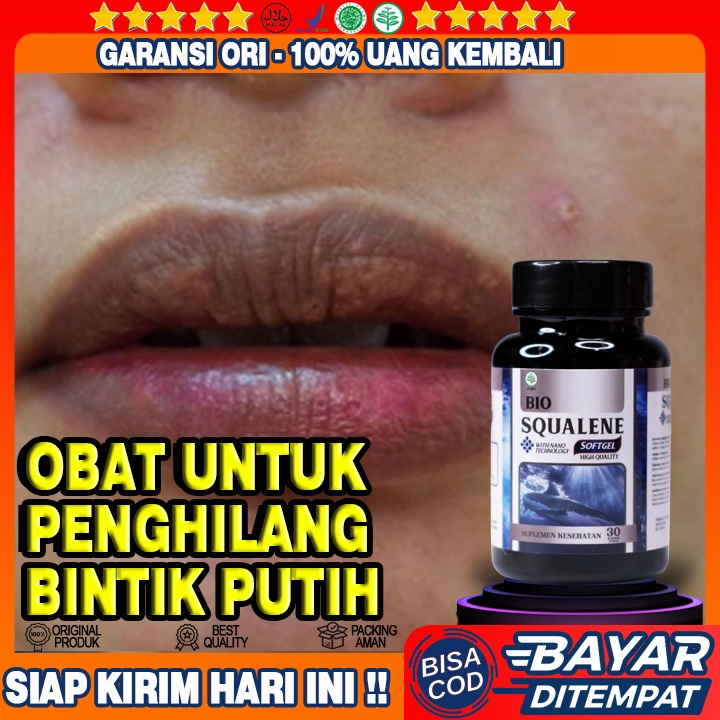 Jual Obat Bintik Putih Di Bibir - Obat Herpes Di Bibir - Obat Milia Di ...