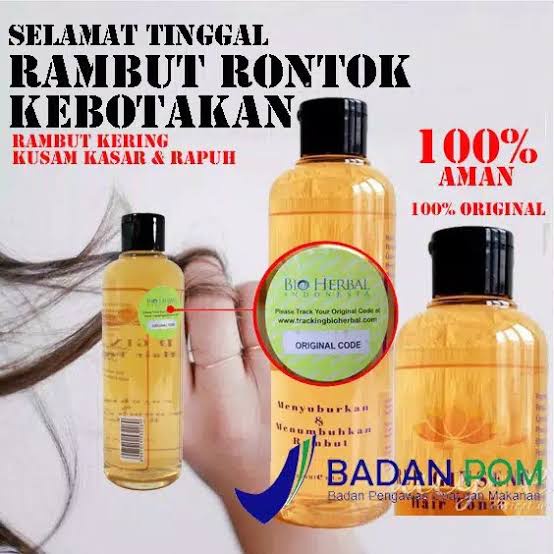 Jual Shampo Sampo Red Ginseng Perawatan Penumbuh Penebal Rambut Botak ...