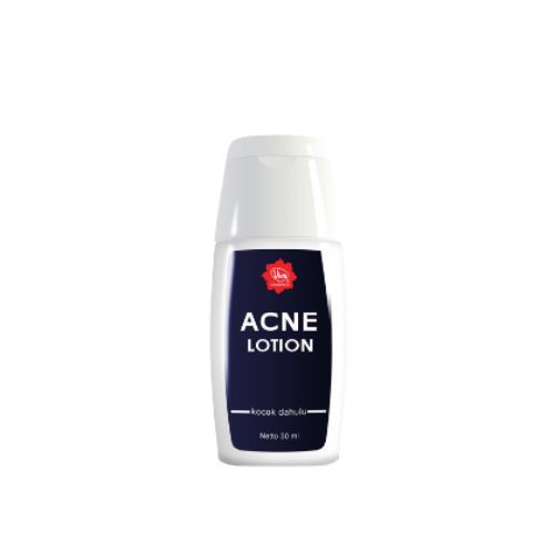 Jual Viva Acne Lotion 30 ml - Lotion Untuk Mengatasi Jerawat | Shopee ...