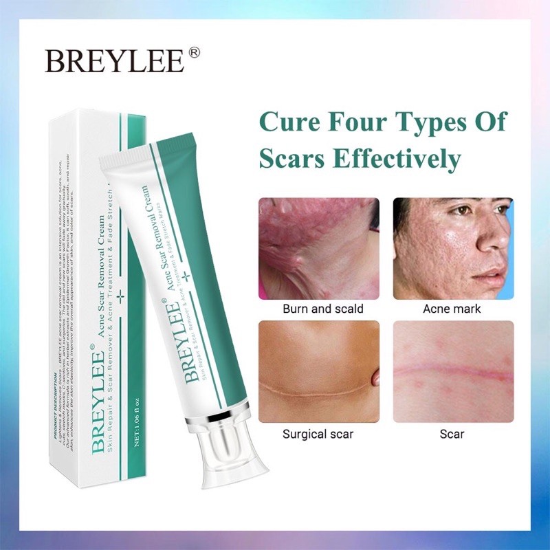 Jual BREYLEE // penghilang bekas luka // Acne Scar Removal Cream 30g Face Cream Skin Repair Skin ...