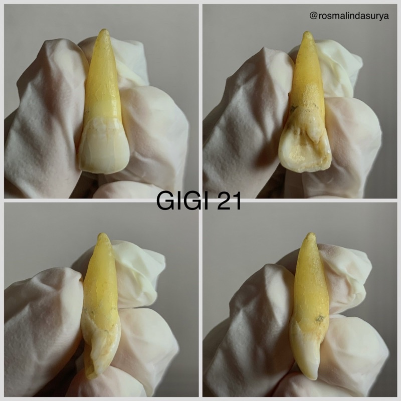 Jual GIGI 21 KONSER ENDO | Shopee Indonesia