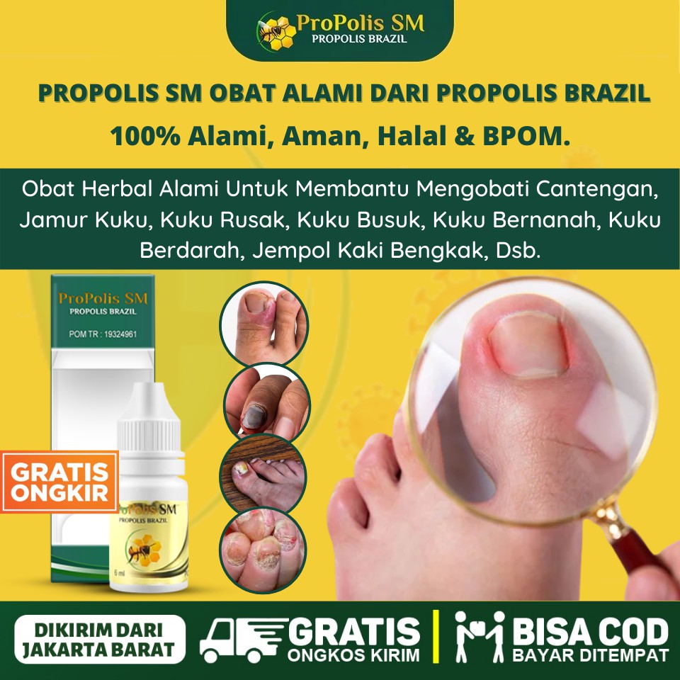 Jual Propolis SM Brazil - Obat Herbal Kaki Cantengan - Kaki Korodok ...