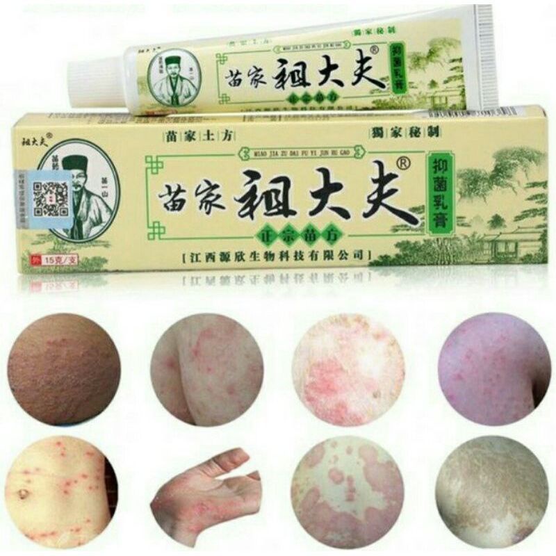 Jual 15g Salap ZuDaiFu / Miao Jia Zu Dai Fu Yi Jun Ru Gao / Salep Gatel ...