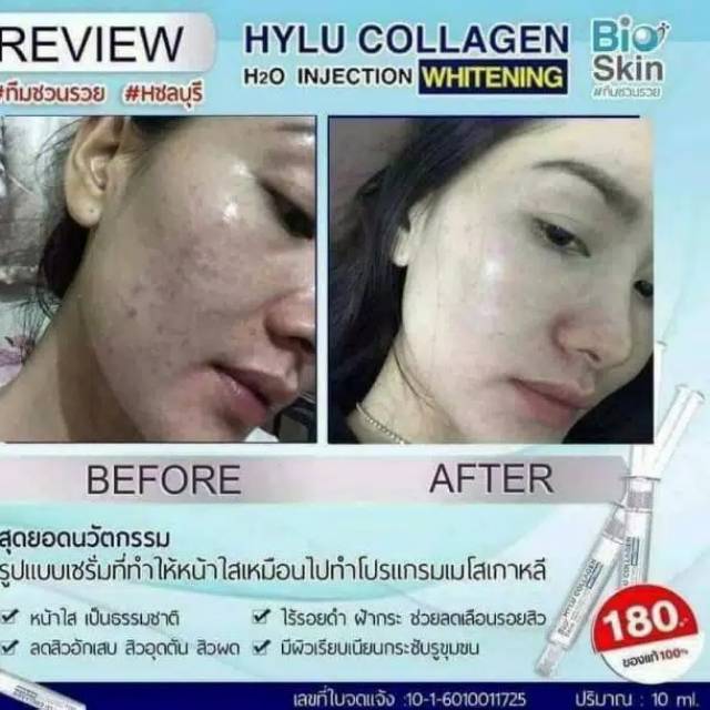 Jual BIO SKIN PWP HYLU collagen H2O injection whitening | Shopee Indonesia