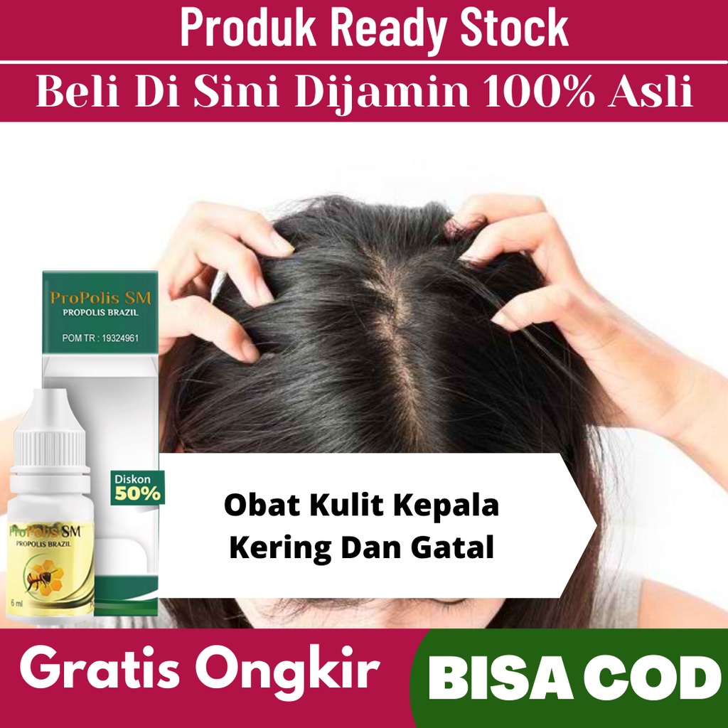 Jual Obat Kulit Kepala Kering Dan Gatal , Kurap Di Kepala , Tinea Capitis , Kulit Kepala ...