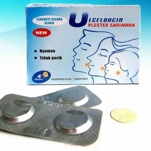 Jual Plester Sariawan Ulceloocin | Shopee Indonesia