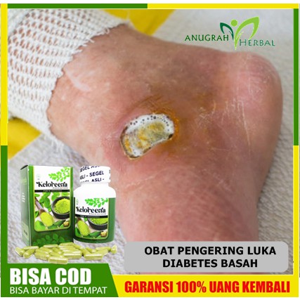 Jual Obat Kapsul Pengering Luka Diabetes Basah - Cepat Mengeringkan ...