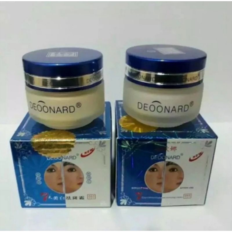 Jual Cream Deoonard Biru A. B / Deoonard Cream Biru Siang, Malem 25g ...