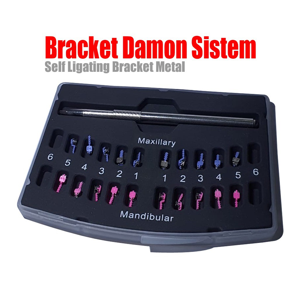 Jual Bracket Damon System self ligating behel damond | Shopee Indonesia