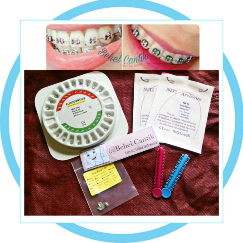 Jual Paket Behel Perawatan Merapihkan gigi (paket Hemat Eurometal ...