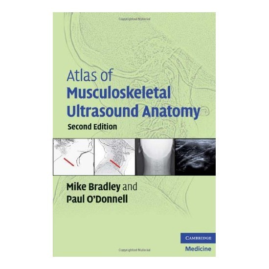 Jual Atlas of Musculoskeletal Ultrasound Anatomy by Mike Bradley ...