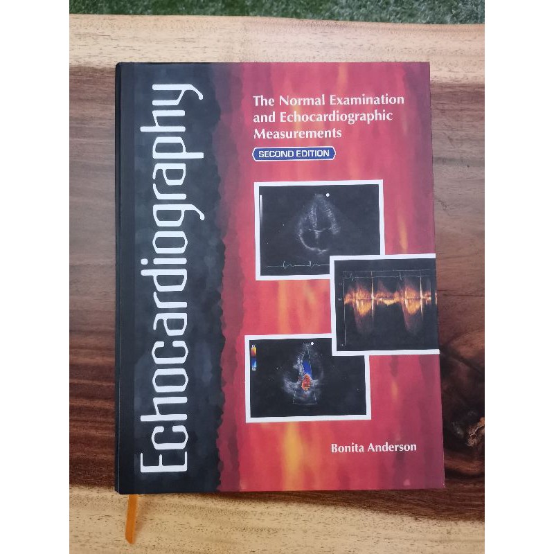 Jual Echocardiography Bonita 2e | Shopee Indonesia