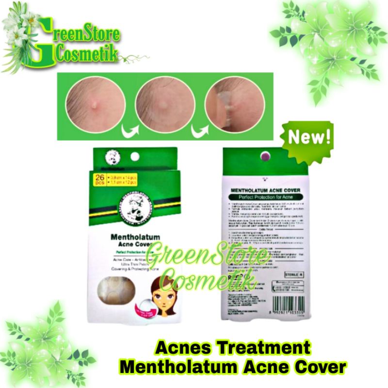 Jual Acnes Treatment Mentholatum Acne Cover/ Acne Spot Patch isi 26pcs ...