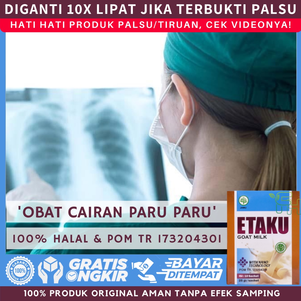 Jual Susu Pembersih Cairan Paru Paru - Obat Pembersih Paru Paru - Penghilang Flek Paru Paru ...