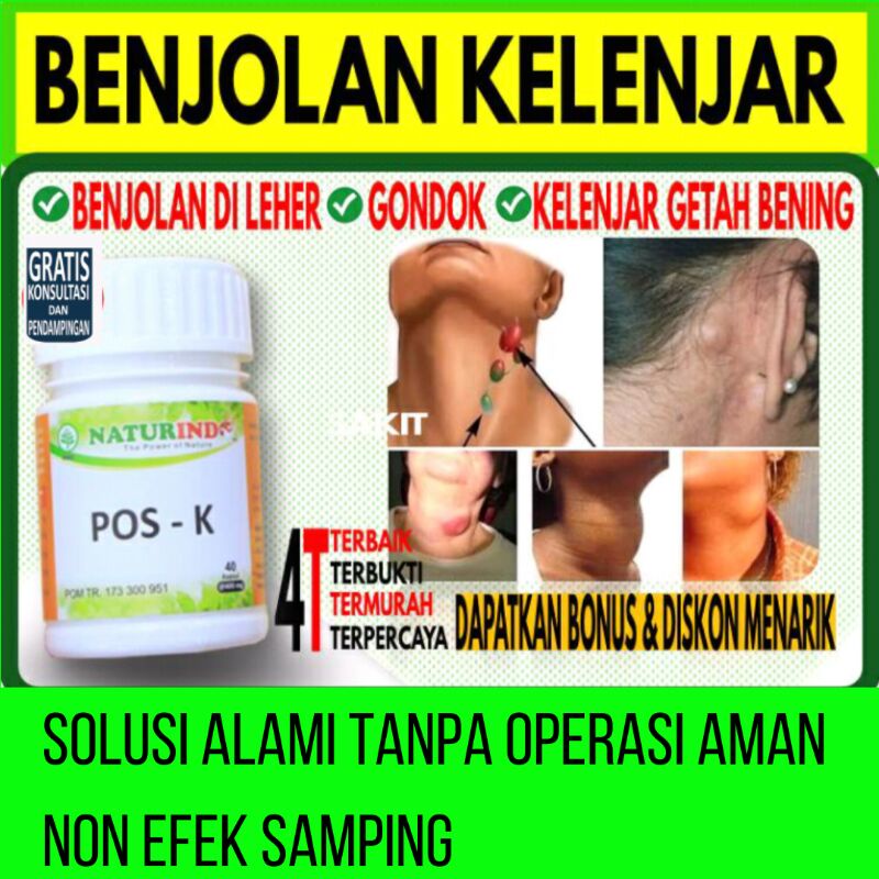 Jual Obat Gondok Sinus Paling Ampuh Obat Benjolan Kelenjar Obat ...