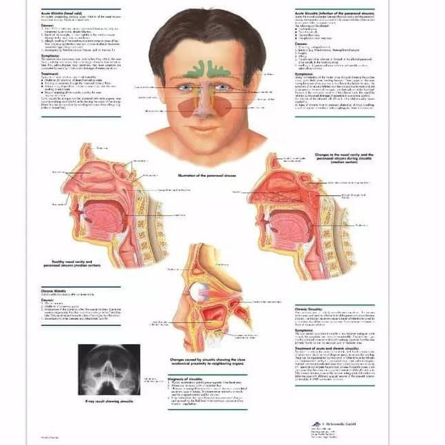 Jual BIONASE ALAT TERAPI HIDUNG PEREDA SINUSITIS / RHINITIS / PILEK ...