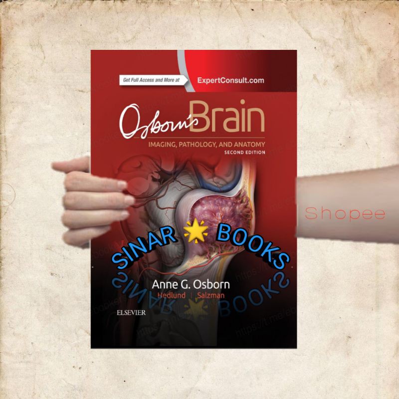 Jual Osborn’s brain : imaging, pathology, and anatomy | Shopee Indonesia