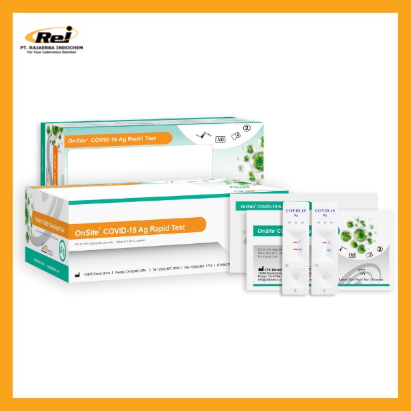 Jual ALAT RAPID TEST ANTIGEN SWAB MANDIRI ONSITE (ISI 20) | Shopee ...