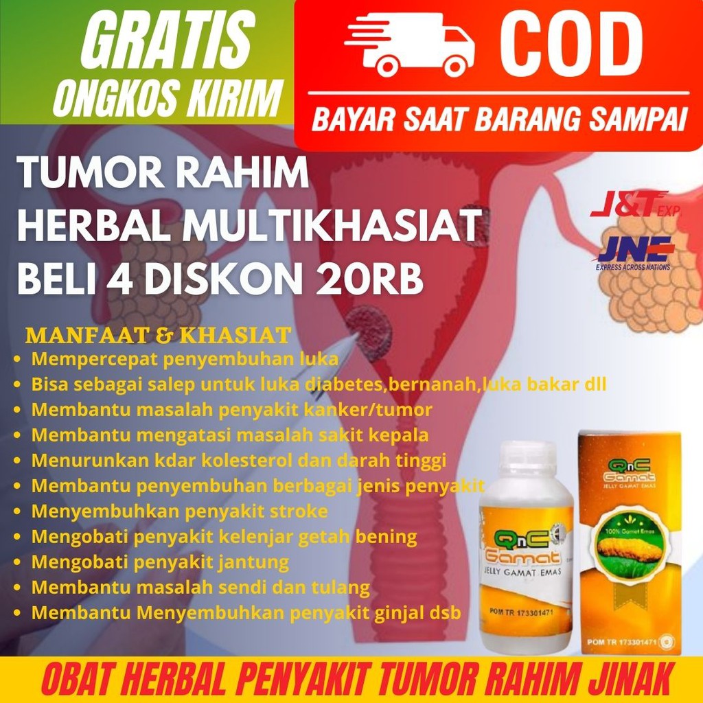 Jual Obat Tumor Rahim Jinak-Kanker Rahim-Obat Herbal Kanker Jinak Ganas ...