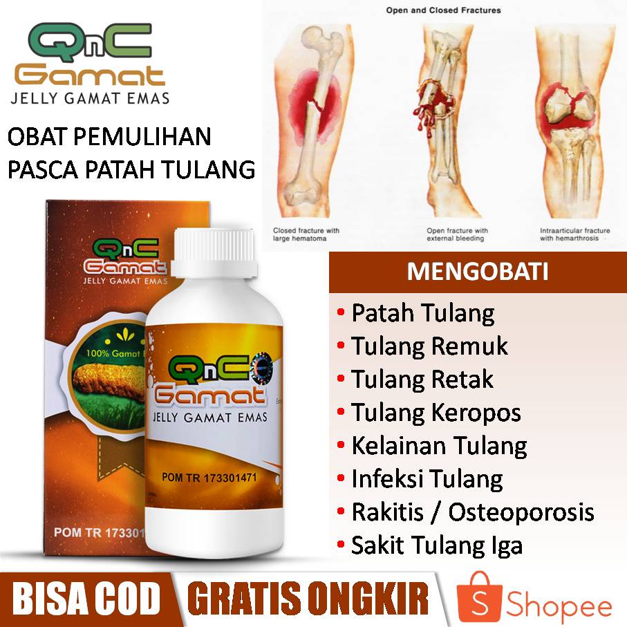 Jual QNC Jelly Gamat Suplemen Sendi Dan Tulang, Obat Tulang Retak ...