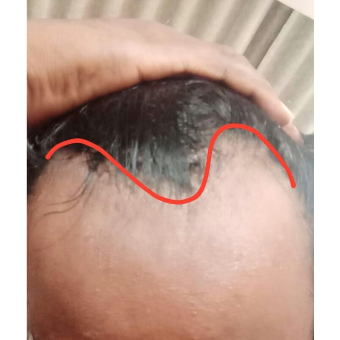 Jual tope penutup botak depan custom request ukuran | Shopee Indonesia