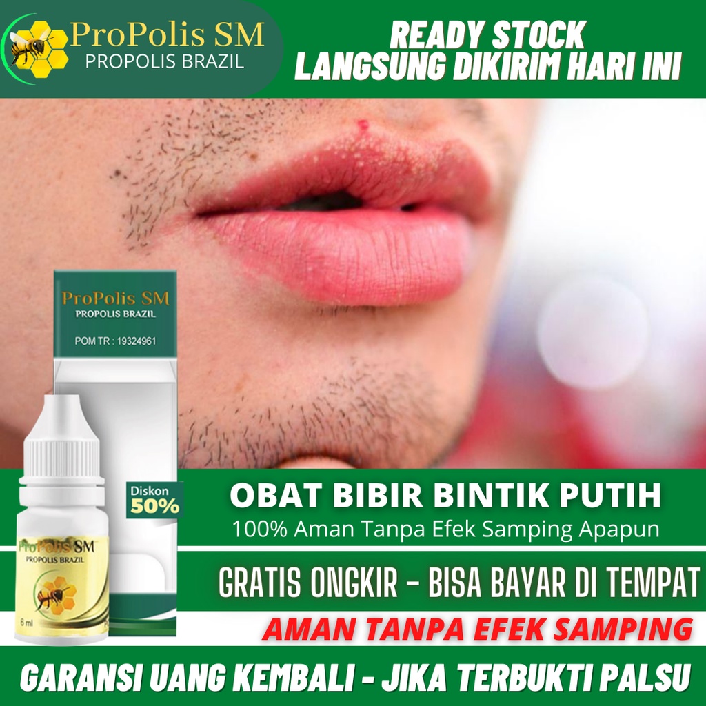 Jual Obat Penghilang Bintik Putih di Bibir, Bintik Putih Pada Bibir ...