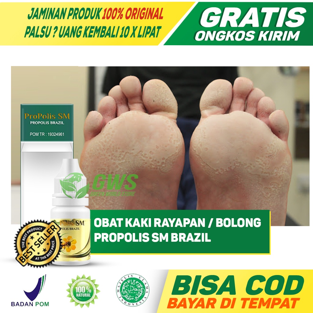 Jual Obat Kaki Rayapan Bau, Pitted Keratolysis, Tetes Oles Telapak ...