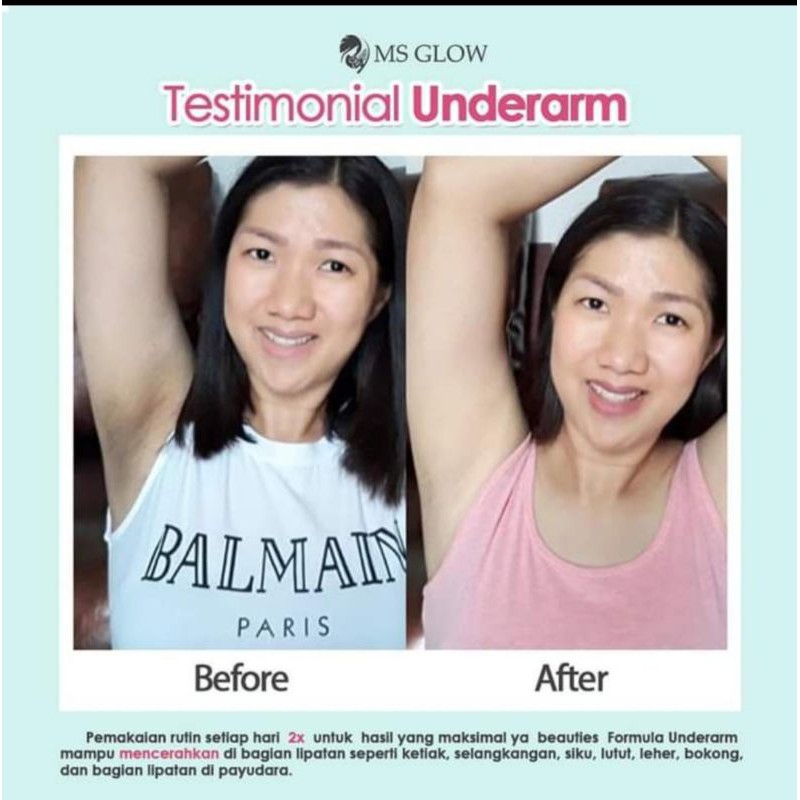 Jual underarm | Shopee Indonesia