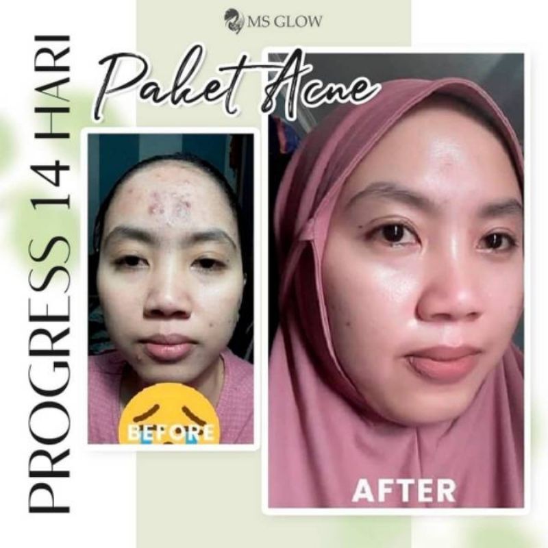 Jual paket ms glow original | Shopee Indonesia