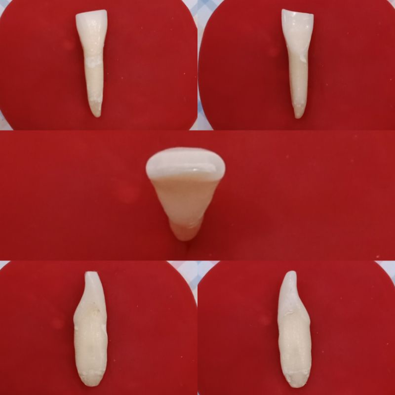 Jual Gigi 42 Gigi Asli Praktikum Gigi Insisif Lateral Kanan Rahang ...