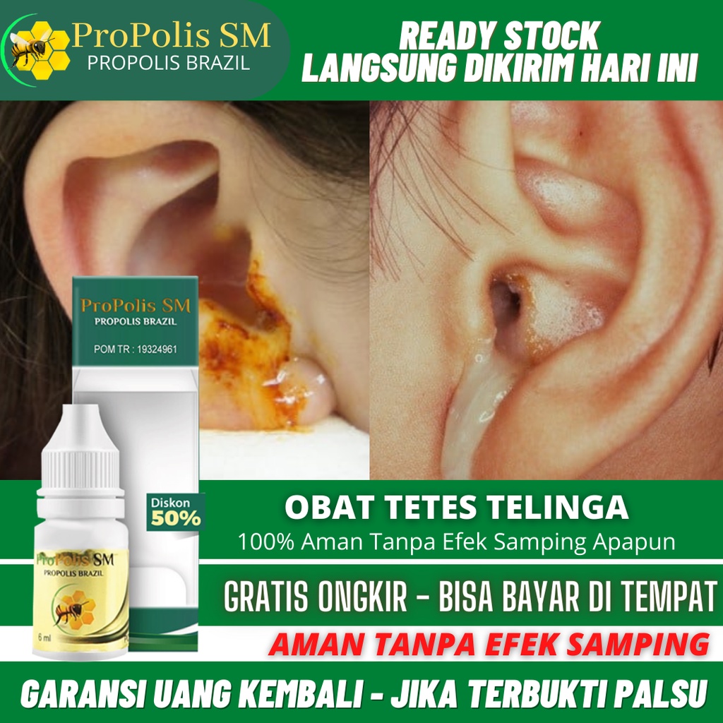Jual Obat Tetes Telinga Bernanah, Obat Congek Menahun, Telinga Berair ...