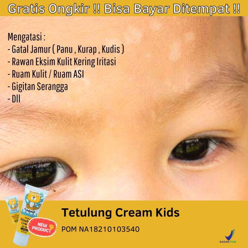 Jual Tetulung Cream Binahong Kids - Salep ruam kulit anak anak dan bayi ...