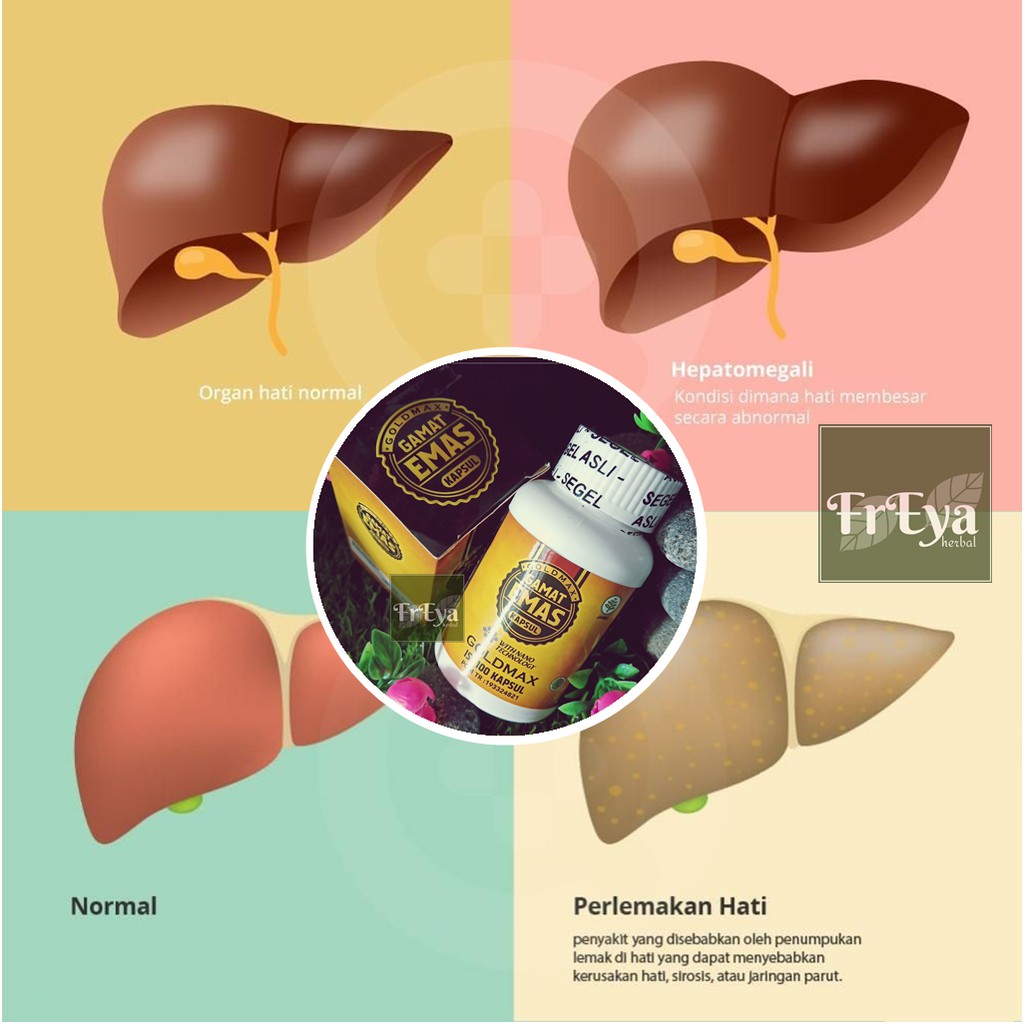 Jual OBAT LIVER, OBAT HERBAL PENYAKIT KUNING, OBAT SIROSIS (HATI ...