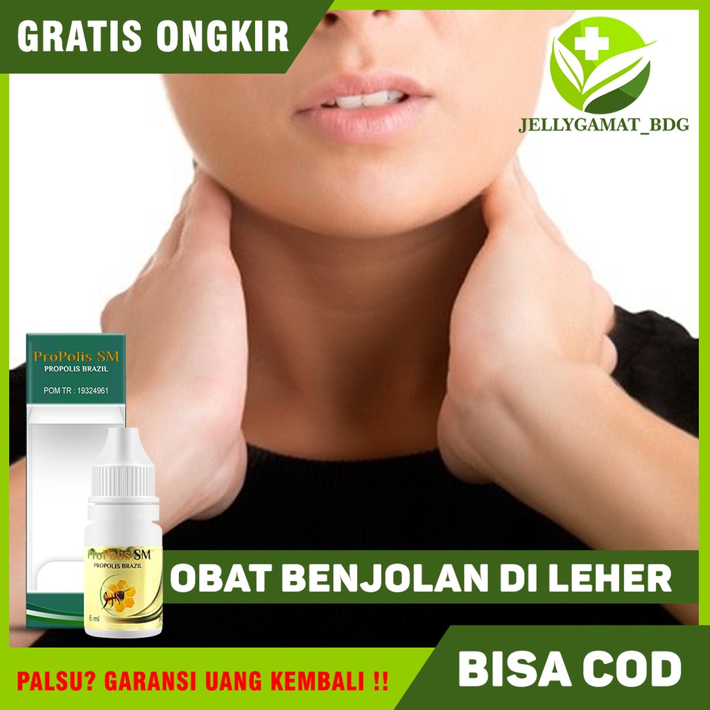 Jual Obat Benjolan Di Leher, Lipoma, Kelenjar Tiroid, Tiroid Bengkak ...