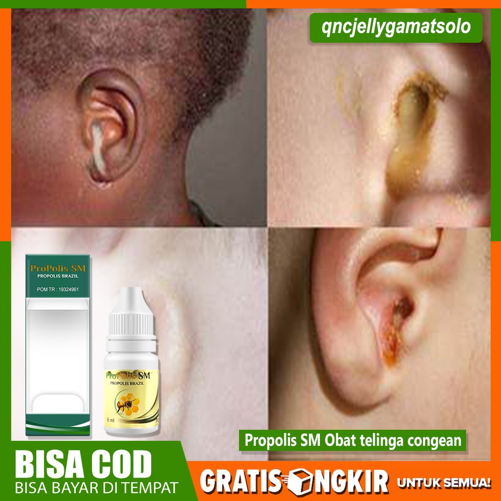 Jual Obat Telinga Congek, Curek, Berair, Bernanah, Keluar Cairan Kuning ...