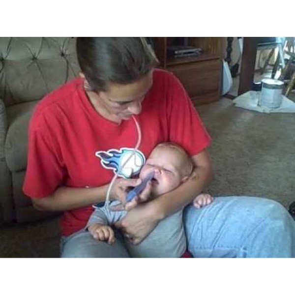 Jual nosefrida penyedot hingus - TINKY1728 | Shopee Indonesia