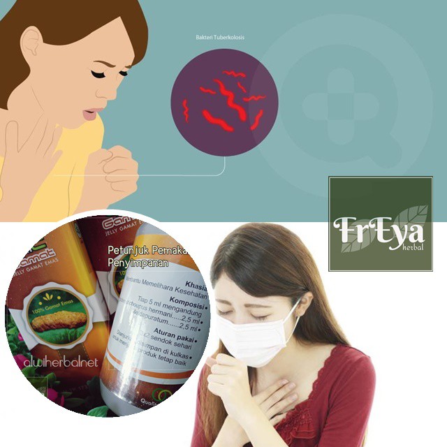 Jual OBAT TBC, OBAT HERBAL TUBERKULOSIS, OBAT TUBERCHULOSIS, OBAT TB ...