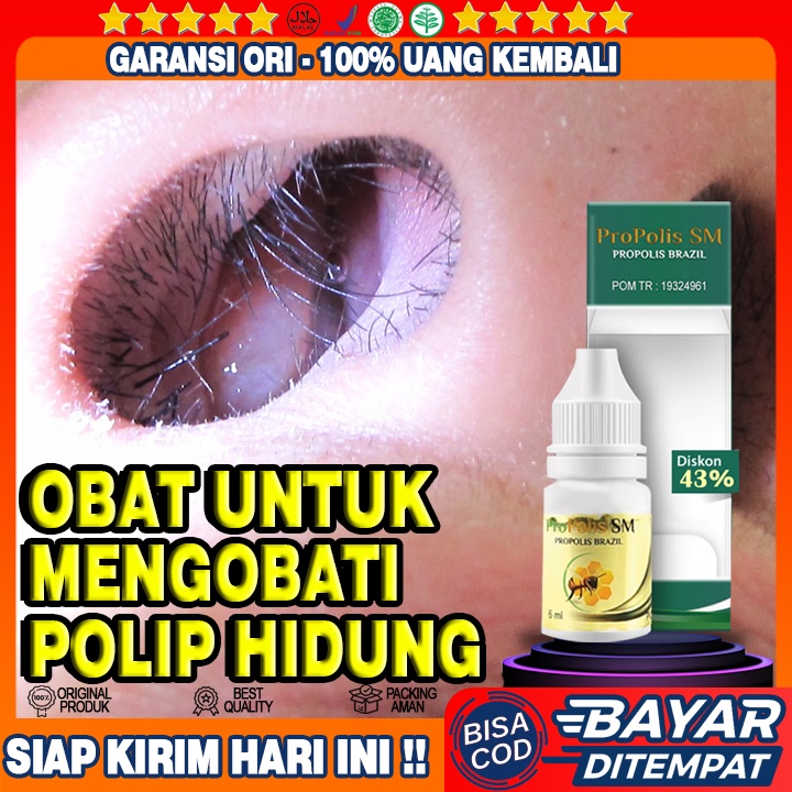 Jual Obat Polip, Obat Sinusitis Menahun, Obat Sinusitis Kronis Akut ...