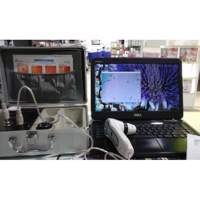 Jual Skin AnaLyzer Kulit / Mesin Cek Kulit Wajah dan Rambut / Analyzer ...