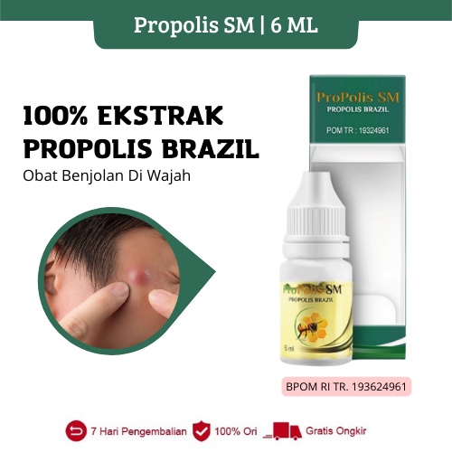 Jual Propolis SM - Obat Benjolan Di Wajah, Jerawat Batu, Milia Di ...