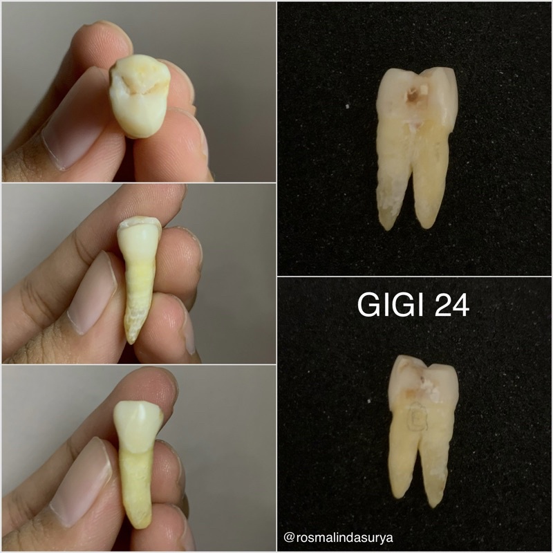 Jual GIGI 24 KONSER ENDO | Shopee Indonesia