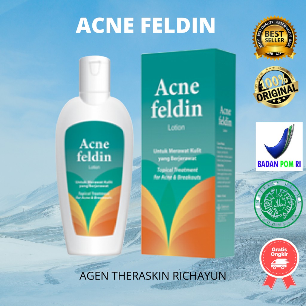 Jual Acne feldin 110 ml | Shopee Indonesia