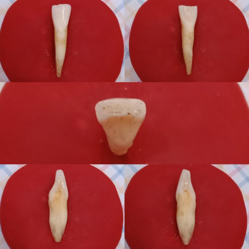 Jual Gigi 42 Gigi Asli Praktikum Gigi Insisif Lateral Kanan Rahang ...