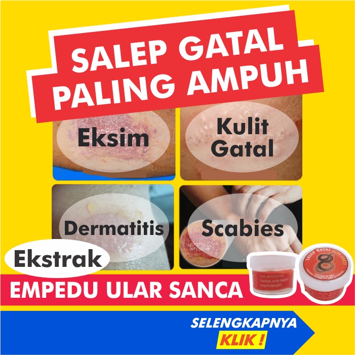 Jual Salep Gatal Paling Ampuh Obat Gatel Saleb Kulit Eksim Kering Exim ...