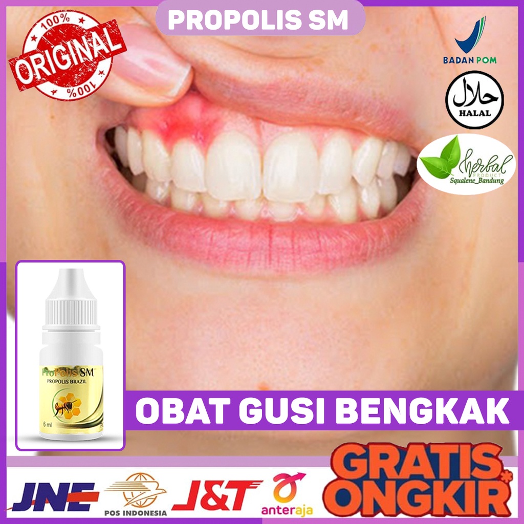 Jual Obat Gusi Bengkak - Obat Gusi Berdarah - Obat Gusi Bernanah - Obat ...
