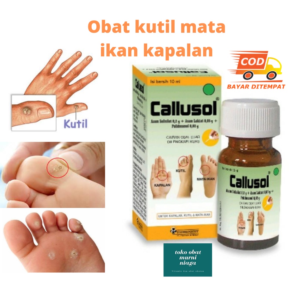 Jual Callusol Obat Kutil calusol Mata Ikan kapalan Kulit Keras bisul ...