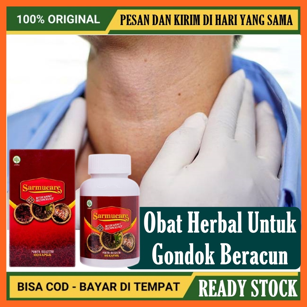 Jual Obat Gondok Beracun - Gondongan - Benjolan di Pipi - Benjolan di ...