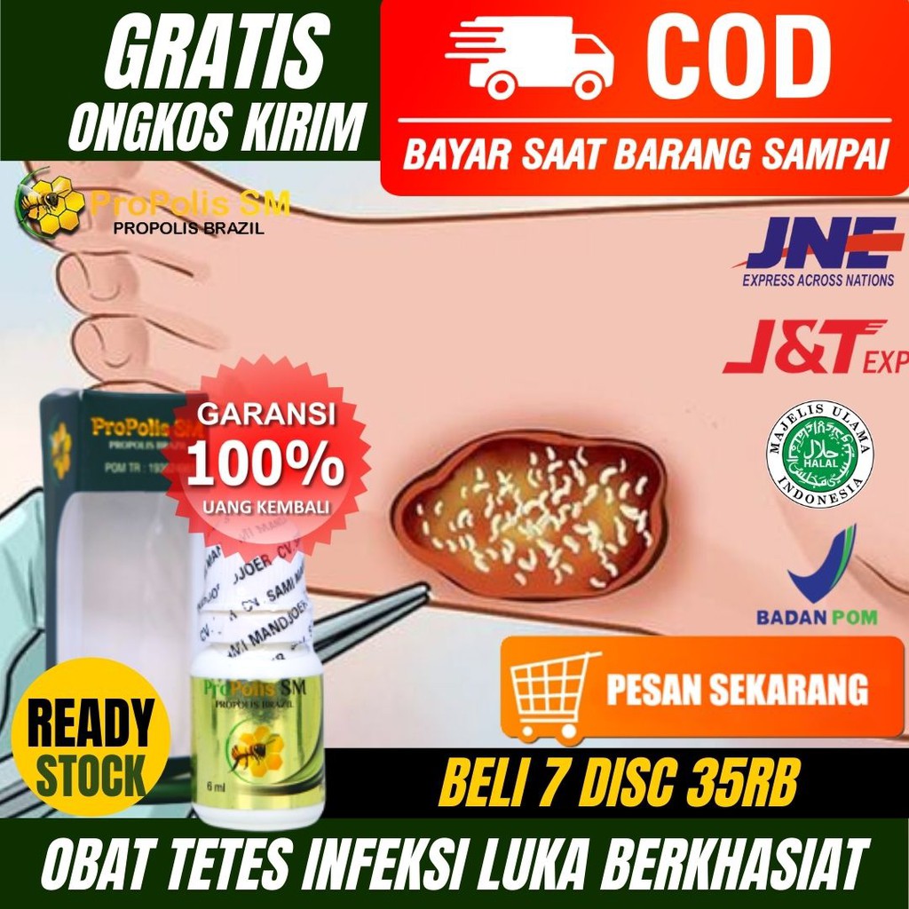Jual Obat Infeksi Luka-Salep Untuk Infeksi Luka-Infeksi Luka Kronis ...