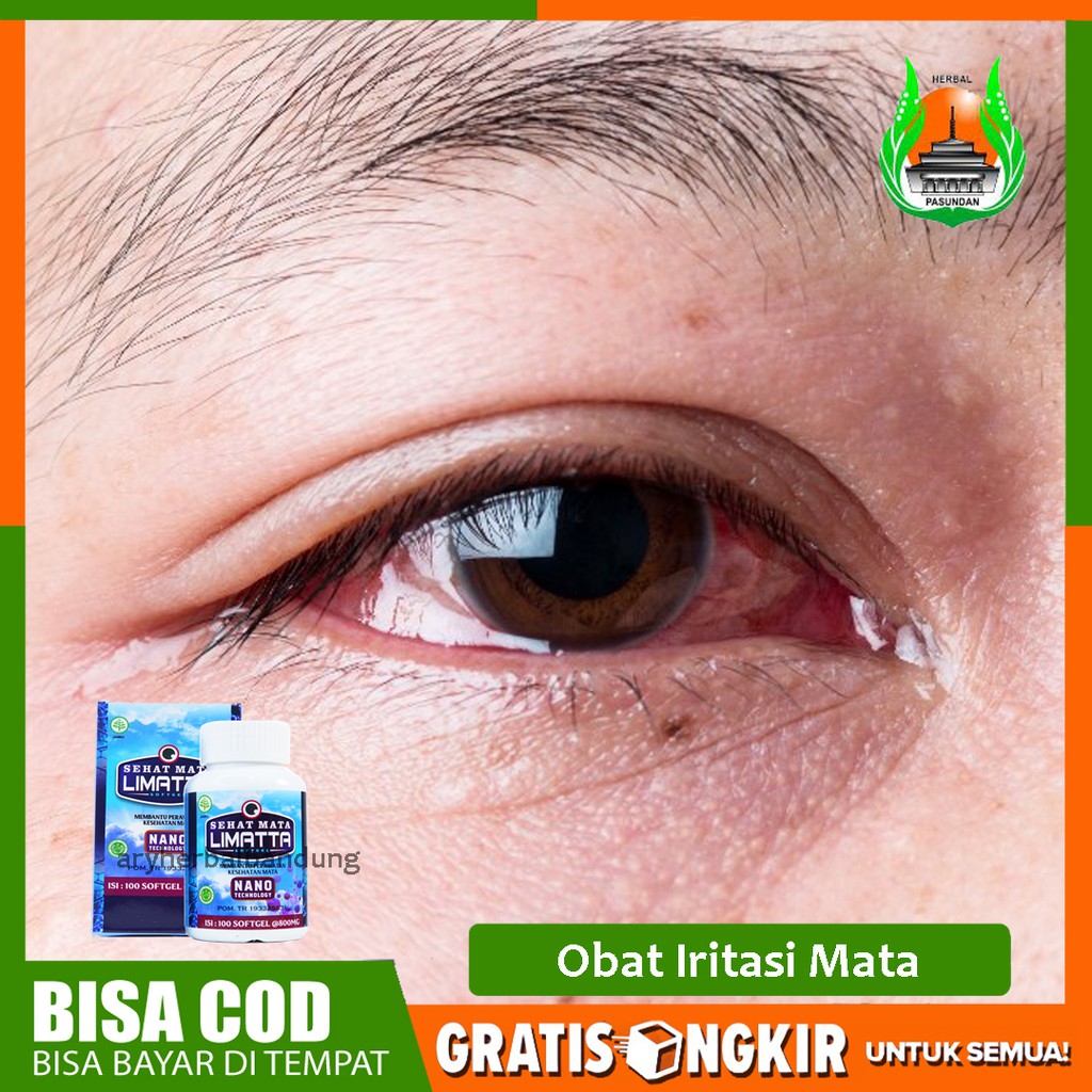 Jual Obat Iritasi Mata - Mata Merah - Mata Gatal Berair Herbal Sehat ...