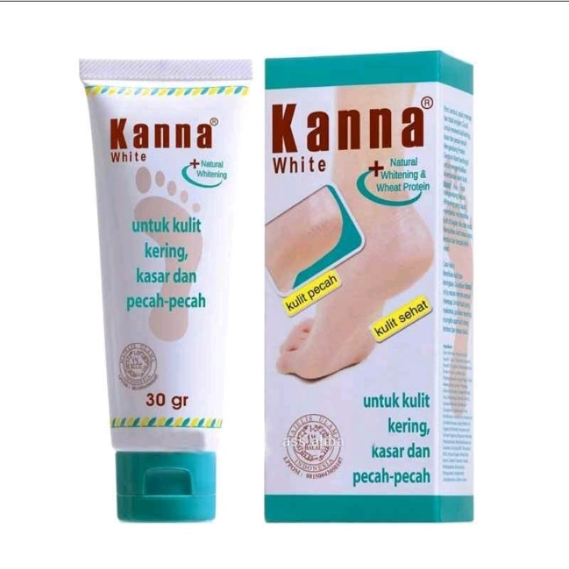 Jual Kanna Soft Cream Kulit Kering Kulit Kasar Pecah-pecah Kanna ...